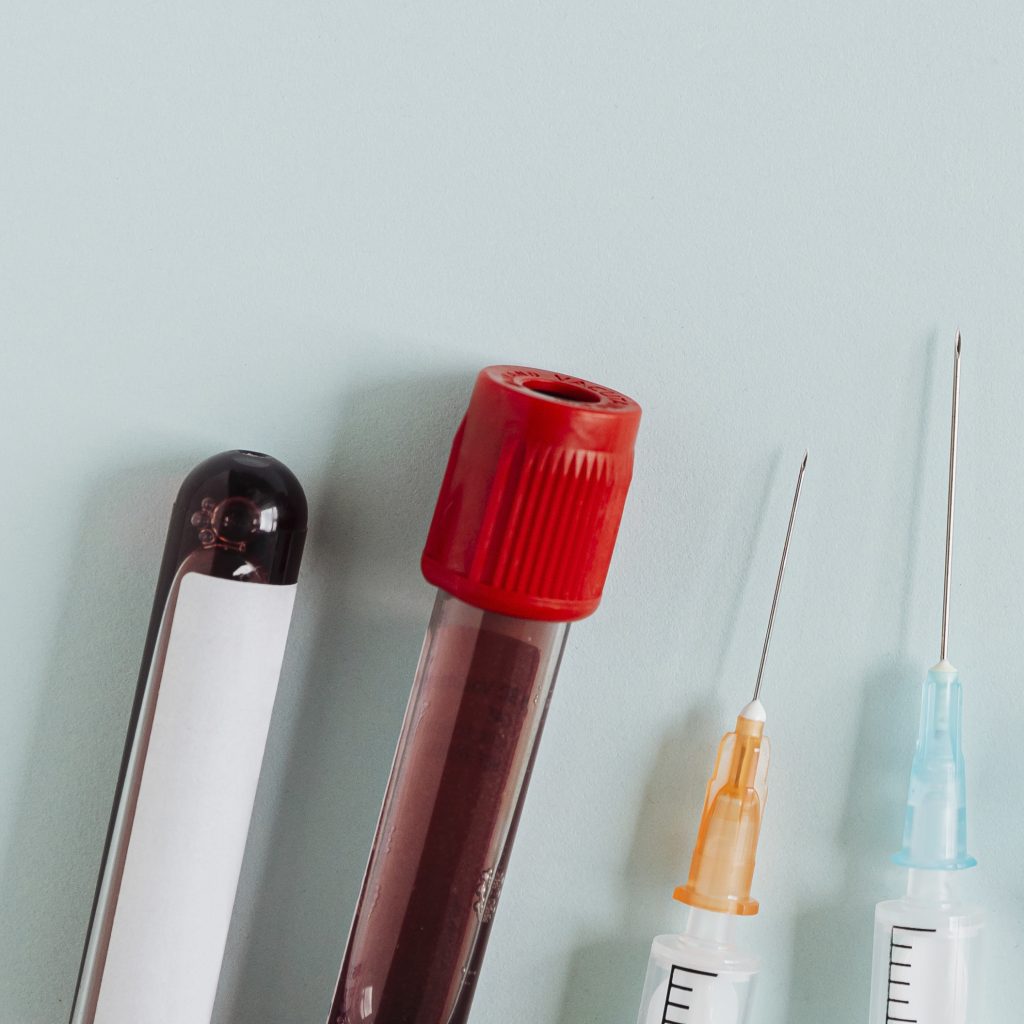 Consultatii Chirurgie Vasculara - Picior Diabetic Umflat